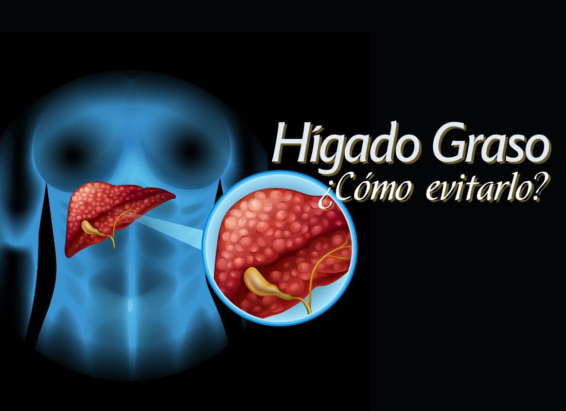 El Rol de la Alimentación en el Hígado Graso - Nutri conCiencia